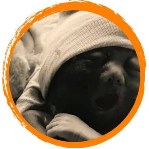 Carpenter Syndrome - The Story of Wyatt Easton Dryden - Terminations ...